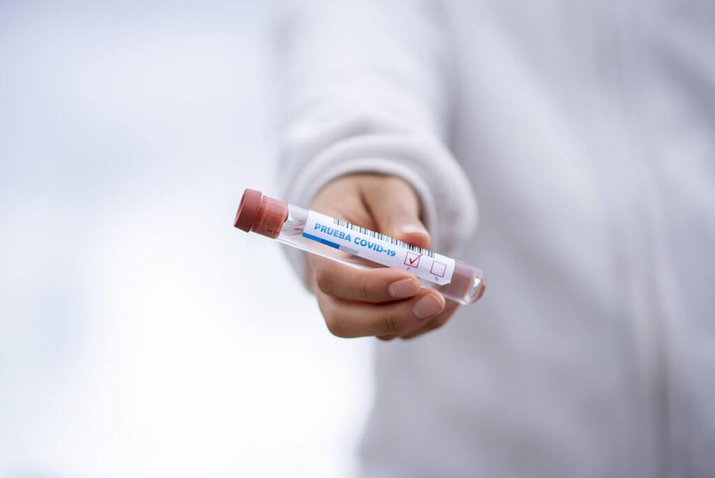 COVID-19 PCR Testi Nedir? PCR Testi Ne Zaman Çıkar? - GecBunlari